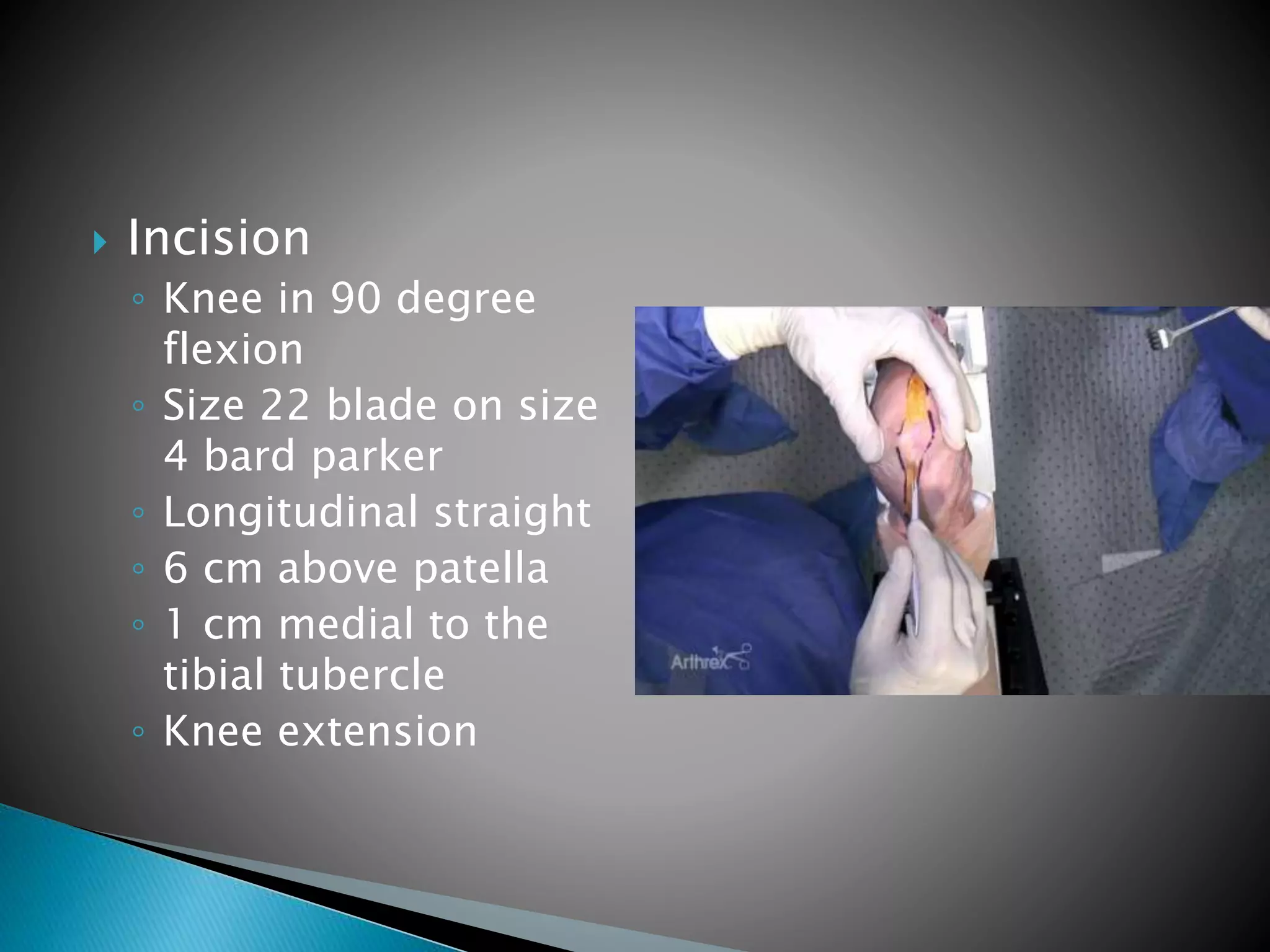 Tkr operative | PPTX