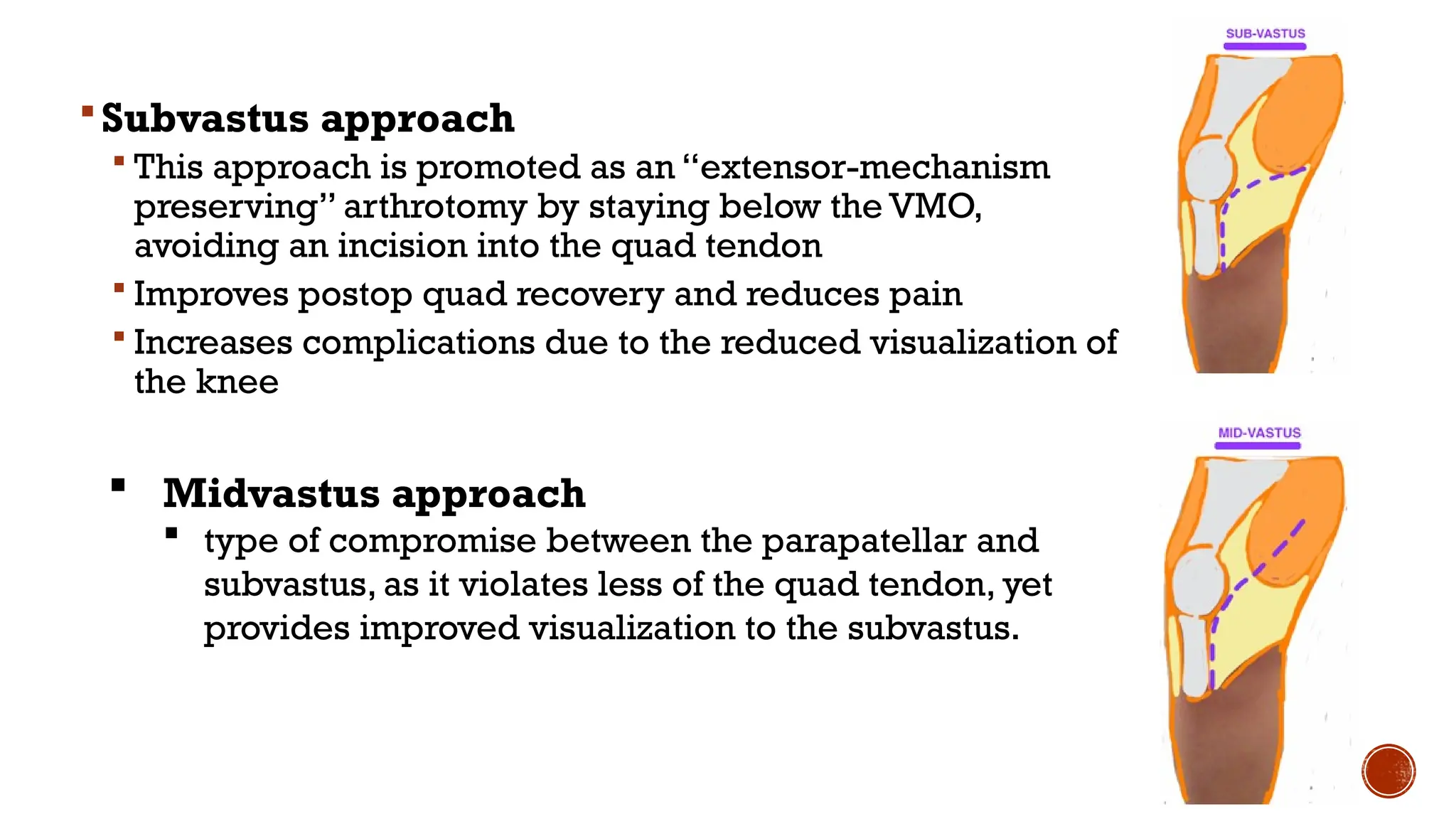 Total Knee Replacement/ arthroplasty ppt.pptx