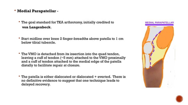 Total Knee Replacement/ arthroplasty ppt.pptx