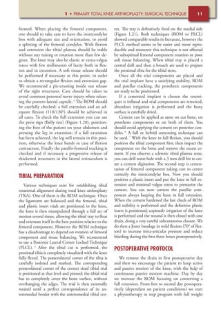 soft tissue balancing in tkr | PDF