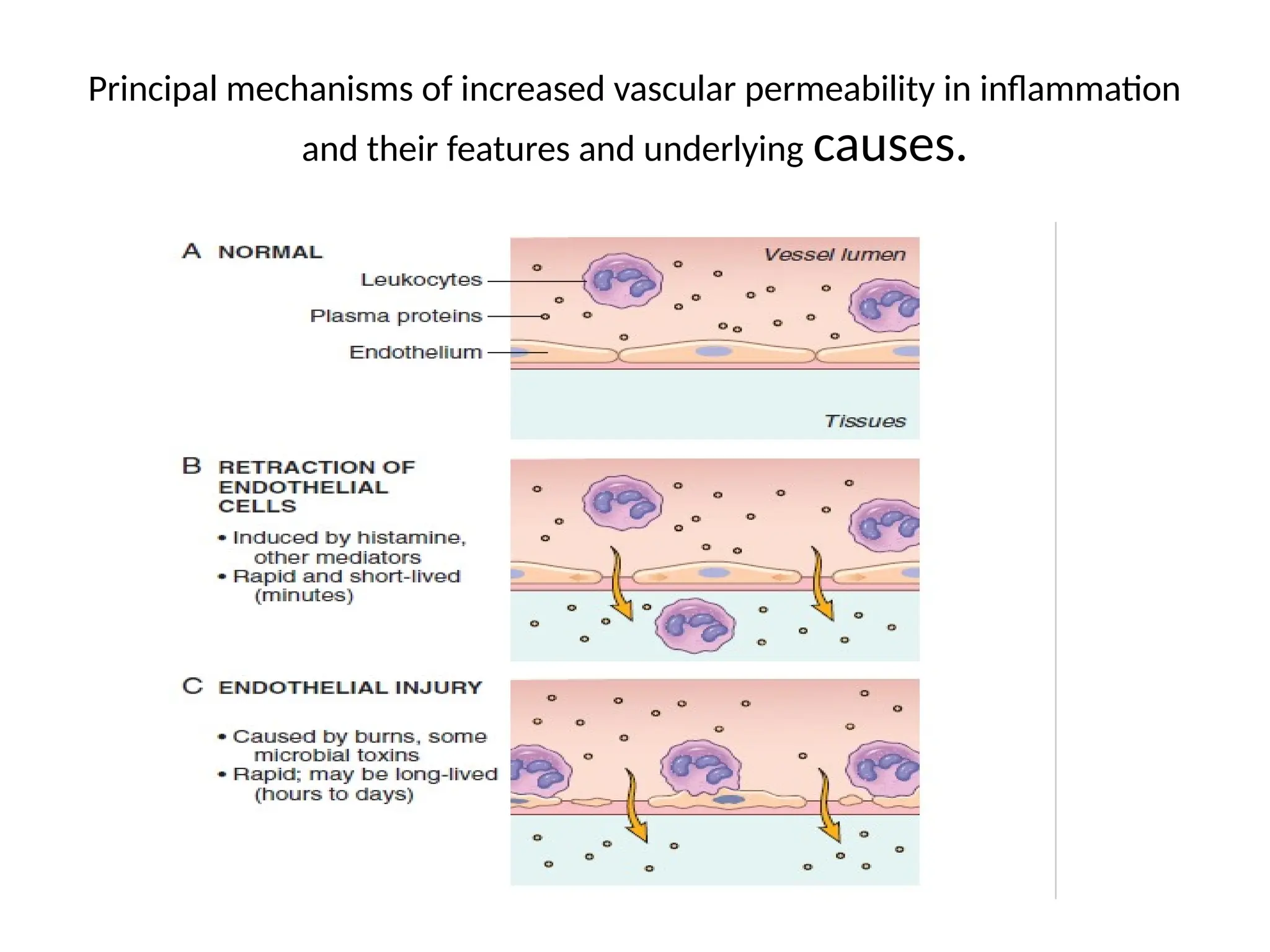 Acute and Chronic inflammation from Robins Basic pathology | PPTX