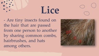 Lesson 3 structure and growth hair cycle | PPT