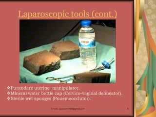 TOTAL LAPAROSCOPIC HYSTERECTOMY | PPT