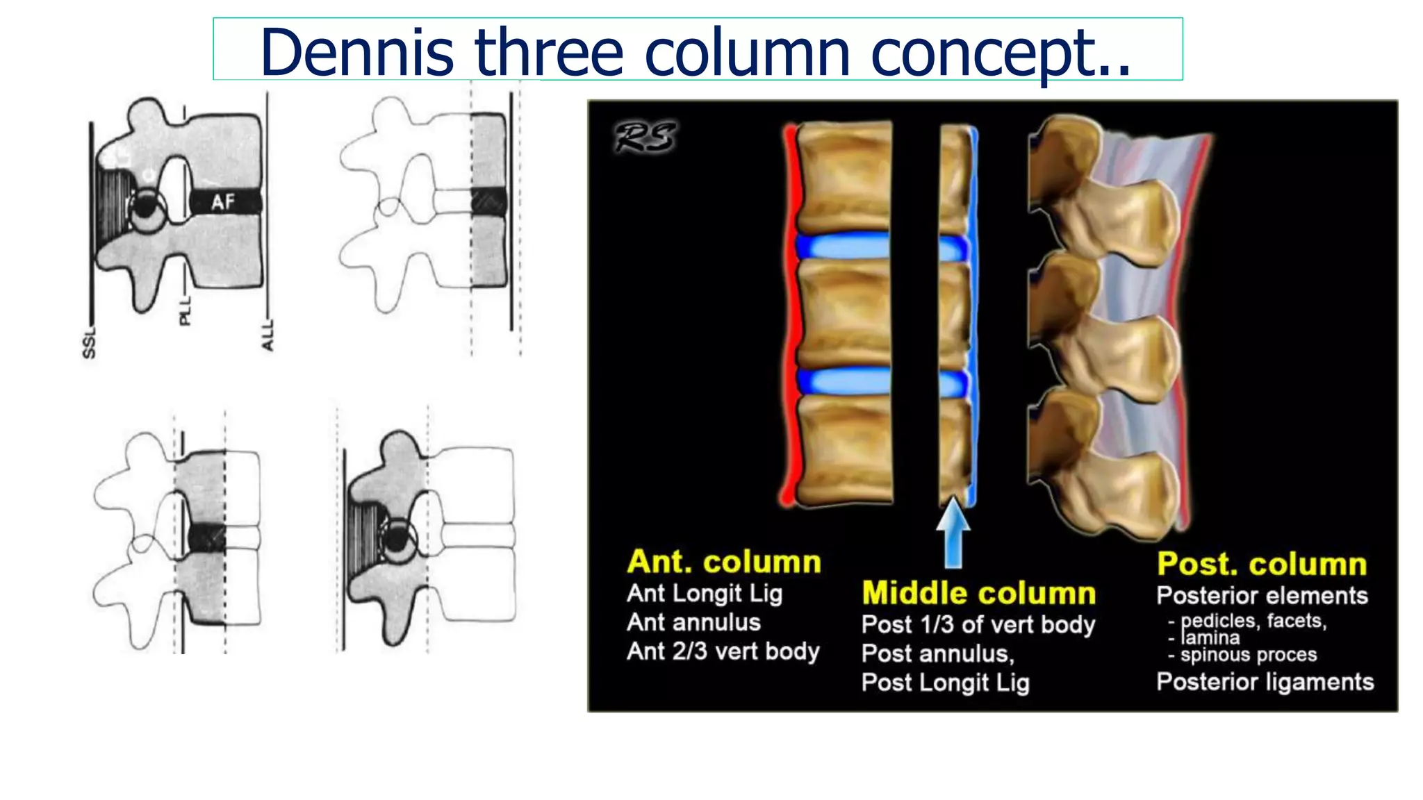 THORACOLUMBAR SPINE INJURIES | PPTX