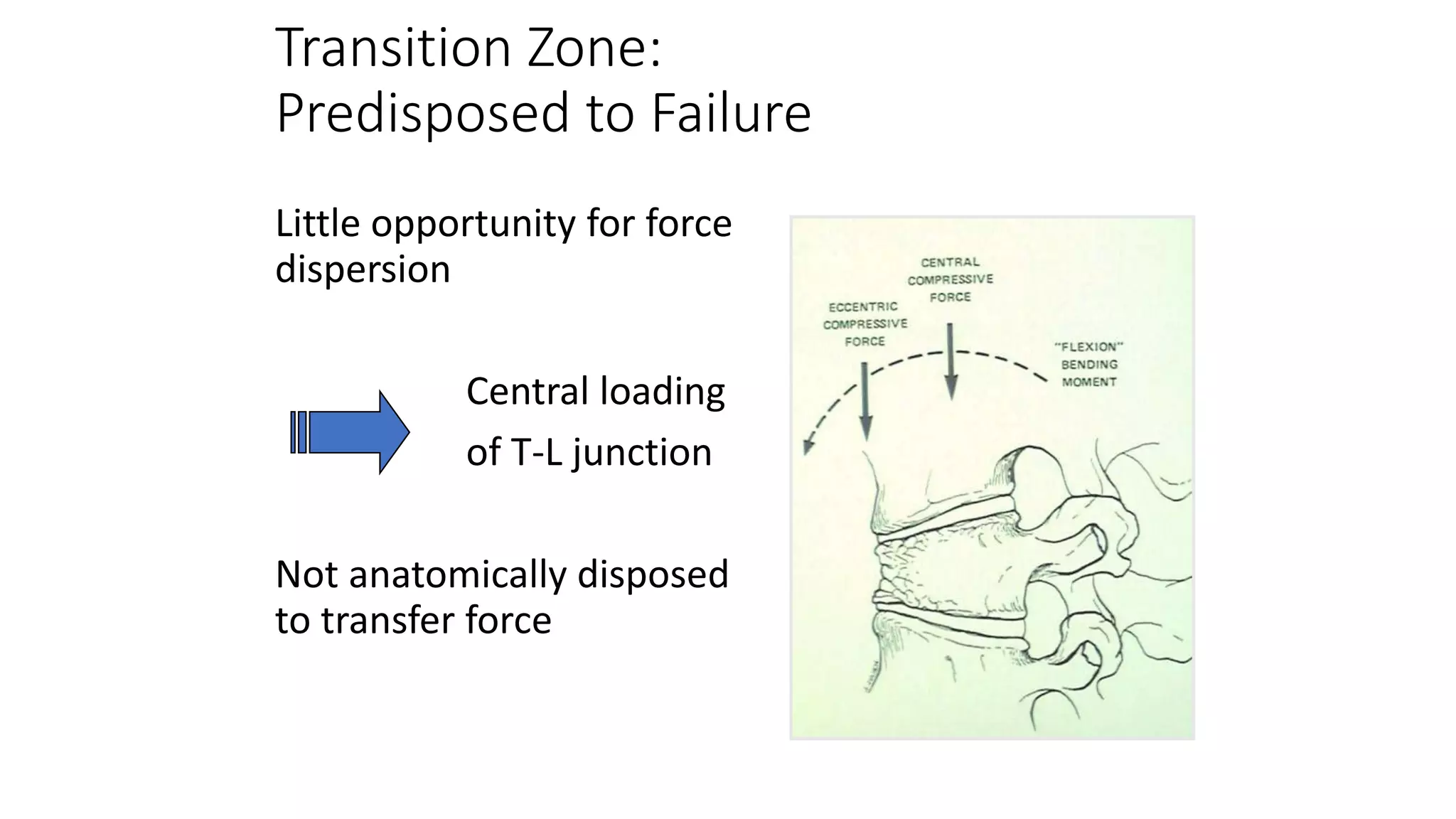 THORACOLUMBAR SPINE INJURIES | PPTX
