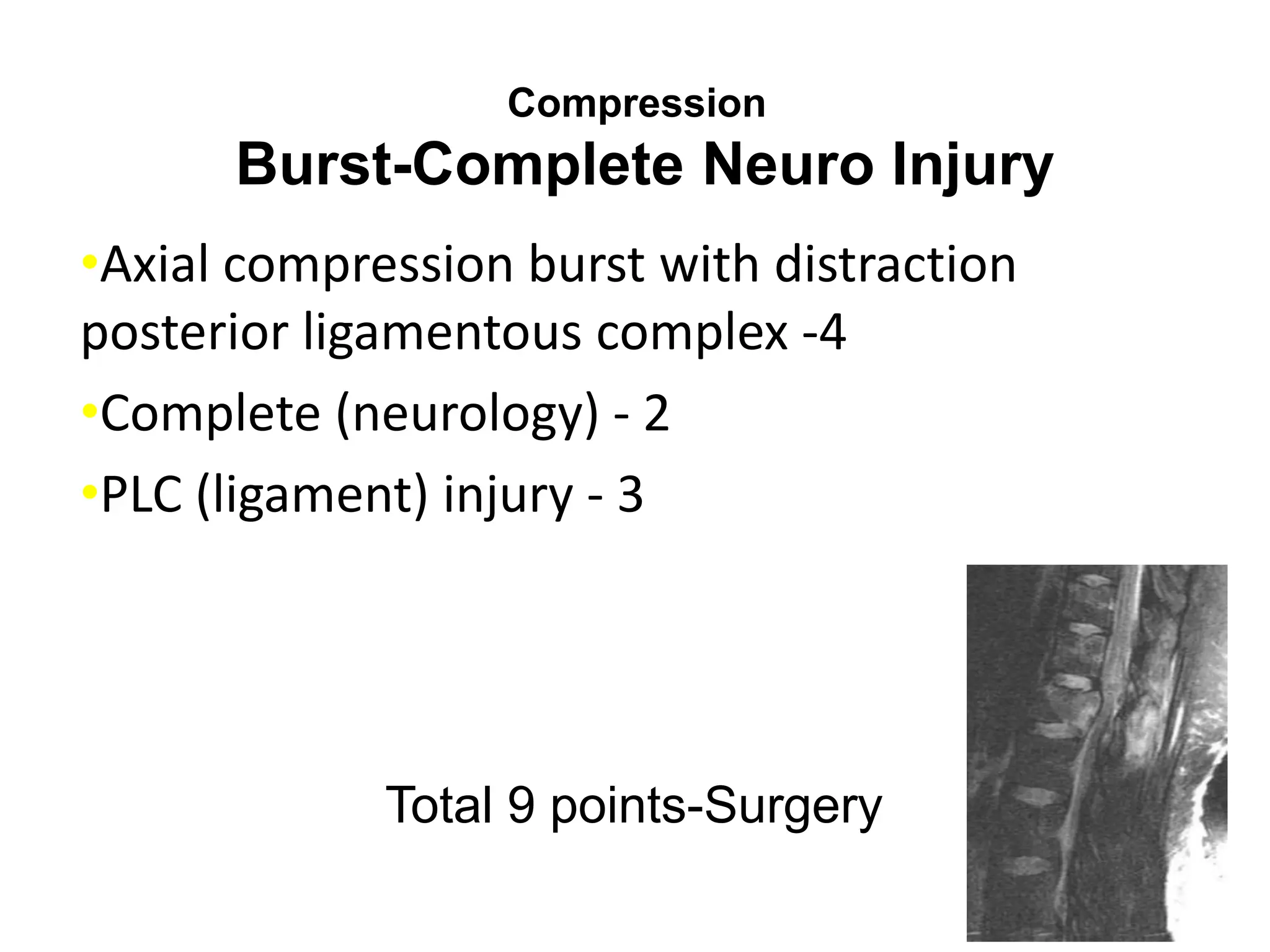 thoracolumbar injury classification severity score .pptx