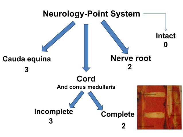 thoracolumbar injury classification severity score .pptx
