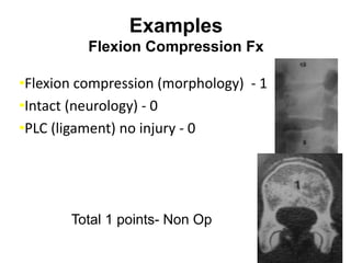 thoracolumbar injury classification severity score .pptx