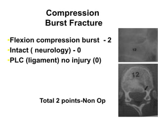 thoracolumbar injury classification severity score .pptx