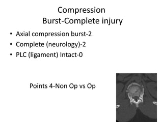 thoracolumbar injury classification severity score .pptx