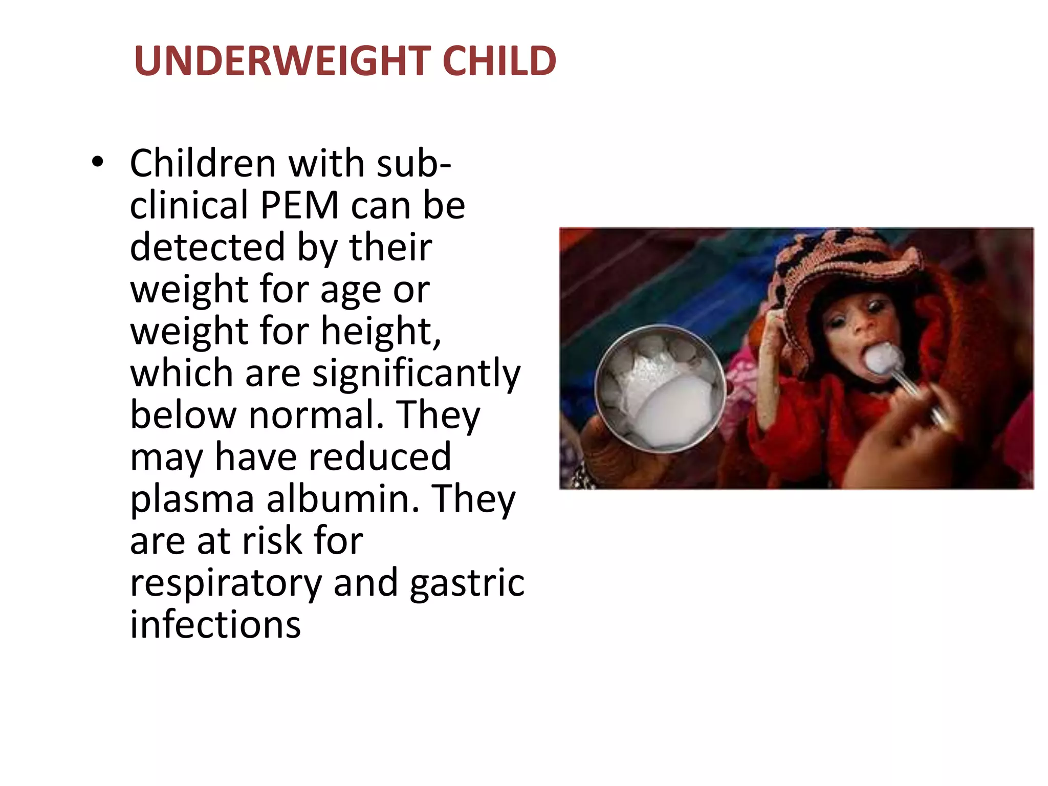 1.malnutrition | PPTX