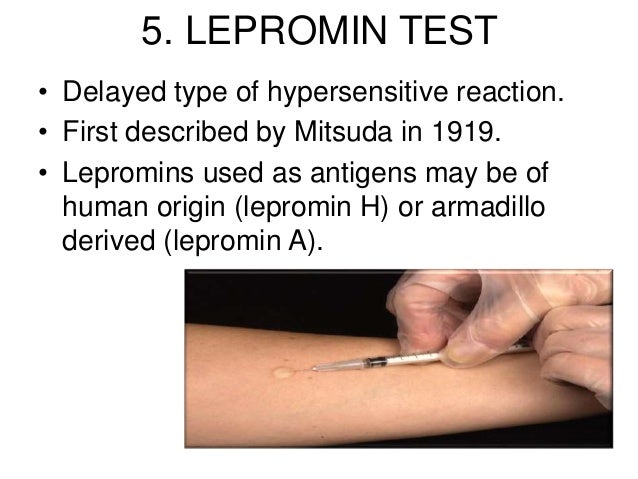 The Leprosy Mission Nepal
