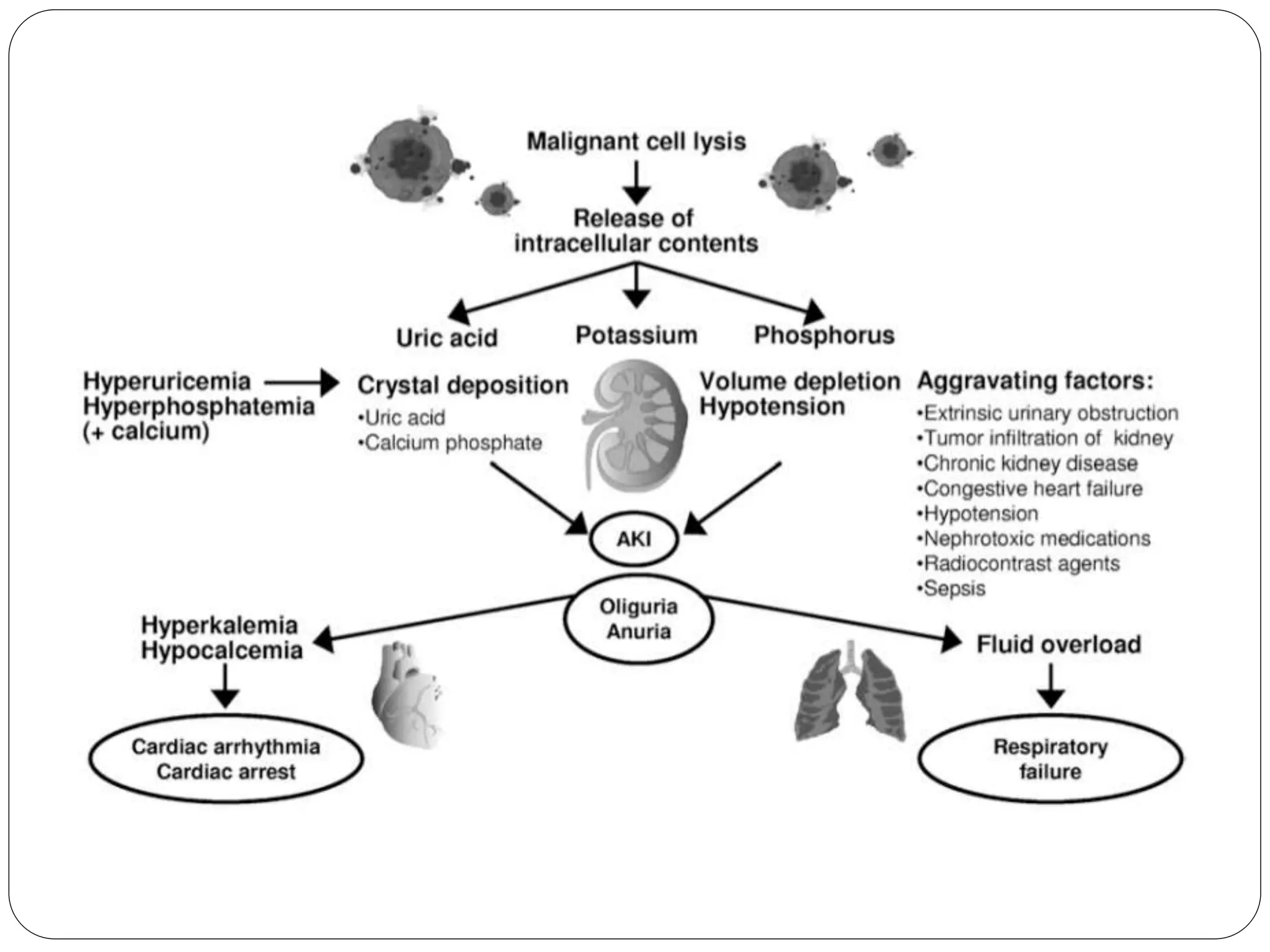 Tumor lysis syndrome | PPTX