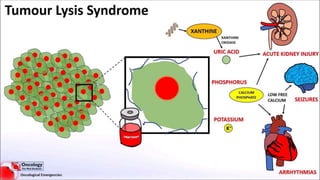 Tumor lysis syndrome | PPTX