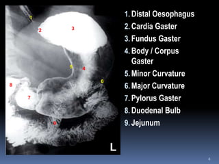 TM 11 ANRAD DIGESTIVUS.pptx