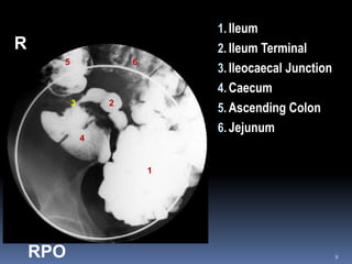 TM 11 ANRAD DIGESTIVUS.pptx