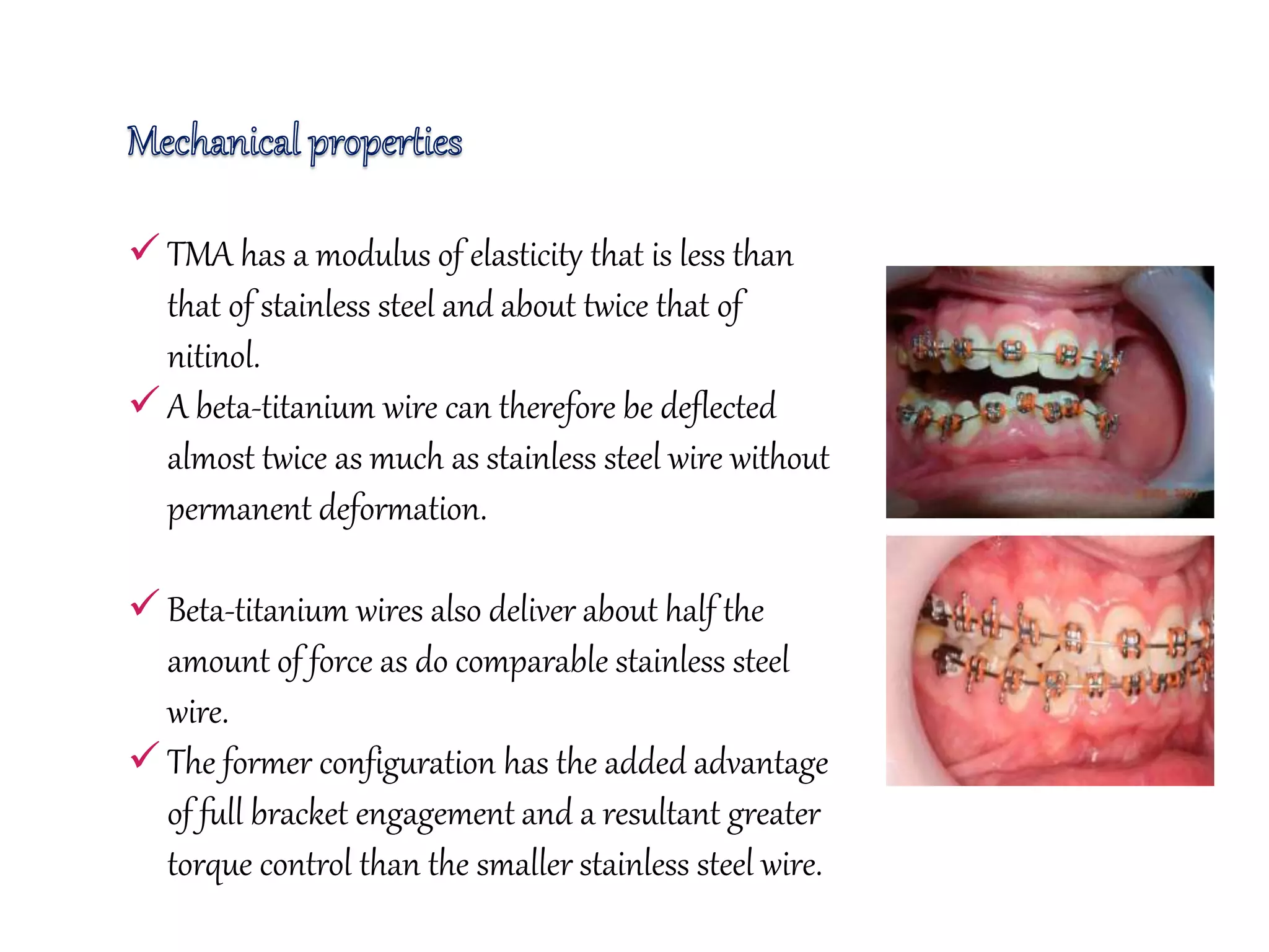 Beta-titanium arch wire (TMA) | PPTX