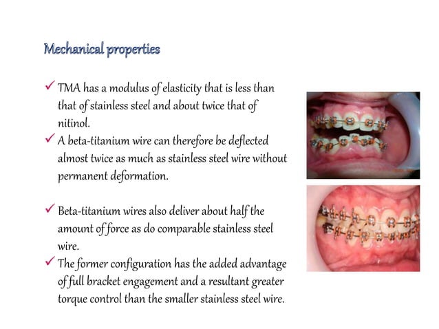 Beta-titanium arch wire (TMA) | PPTX | Geology | Science