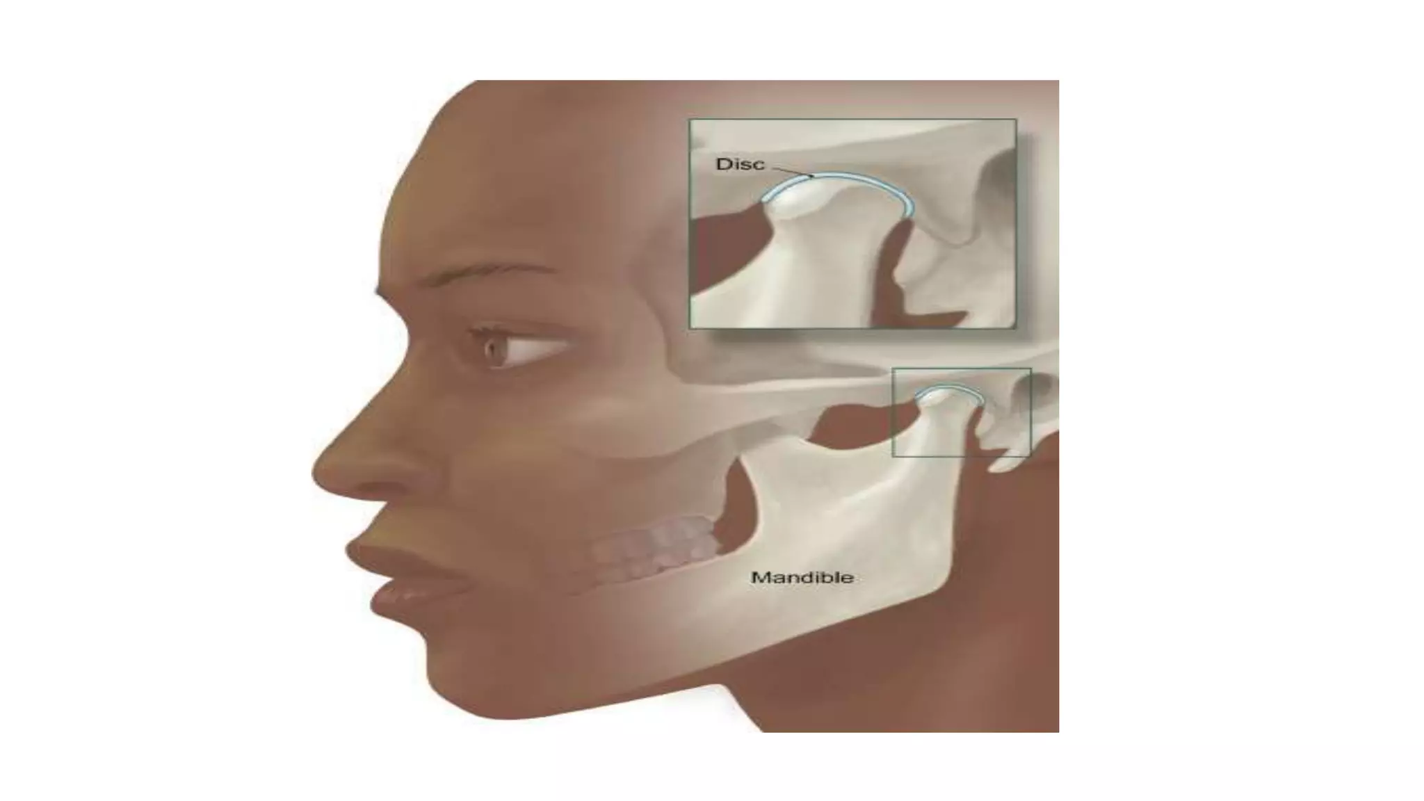 Temporomandibular Joint Disorders (TMD) | PPTX