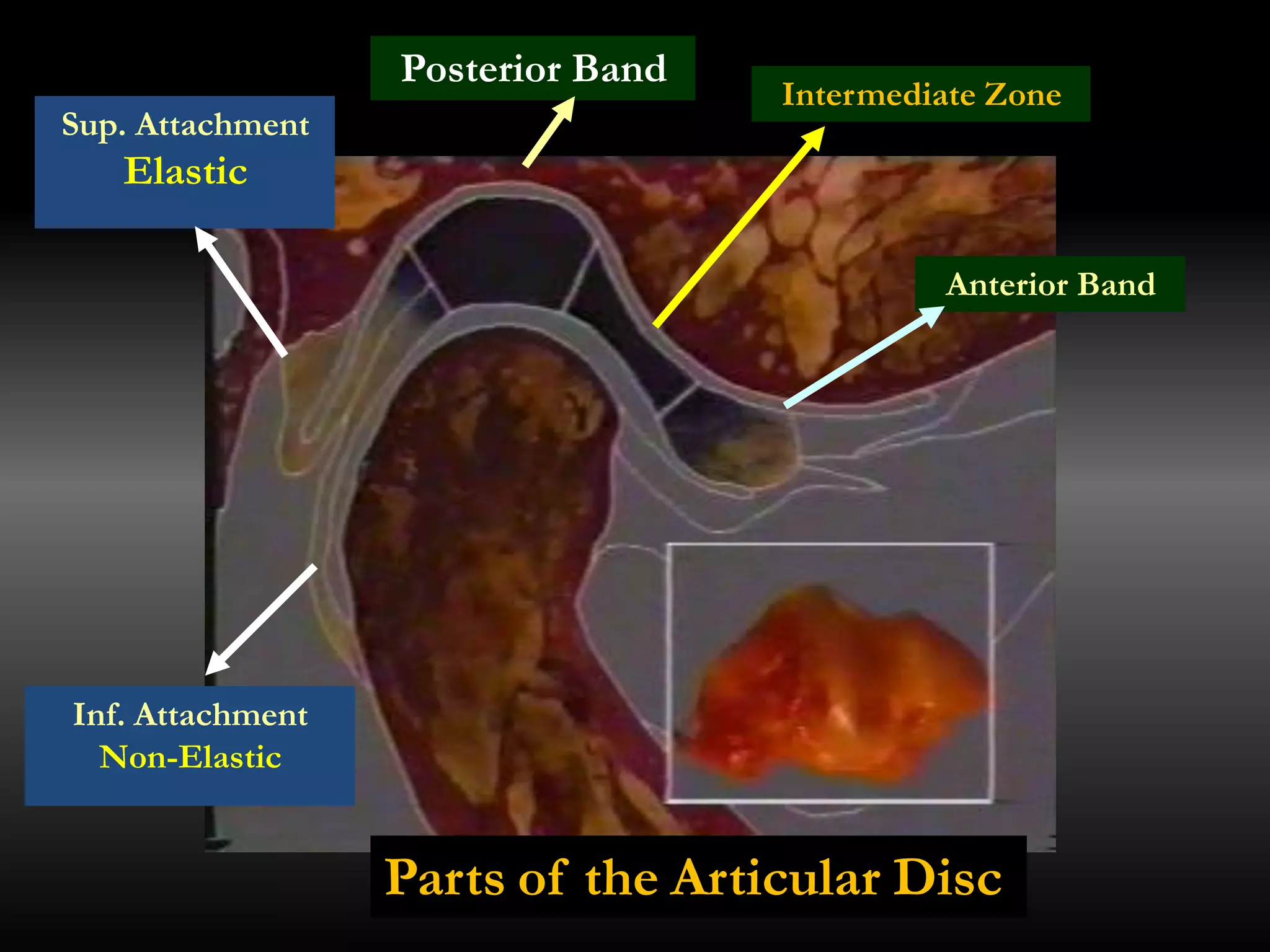 TMD's and occlusal splint therapy | PDF | Bone and Joint Conditions ...