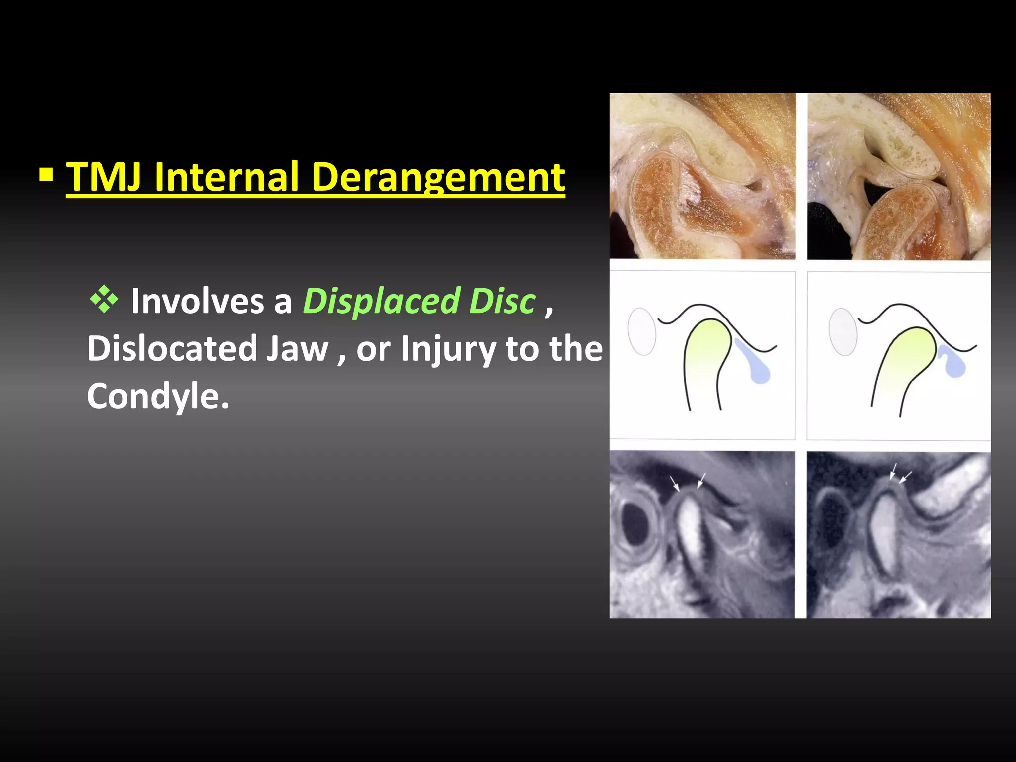 TMD's and occlusal splint therapy | PDF