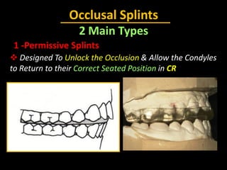 TMD's and occlusal splint therapy | PDF