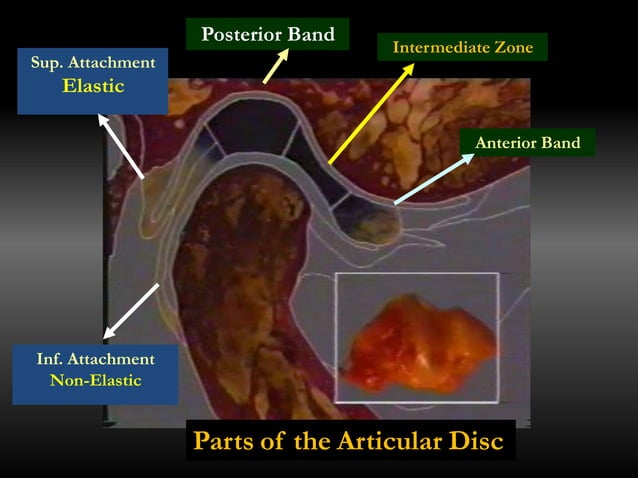 TMDs and occlusal splints therapy | PDF