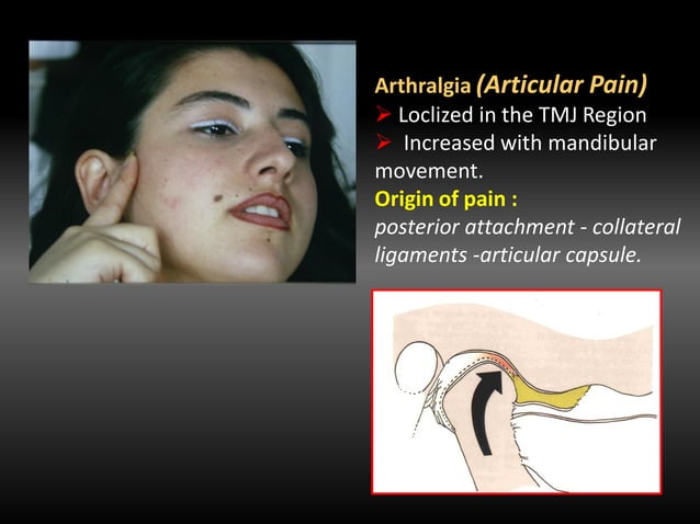 TMDs and occlusal splints therapy | PDF