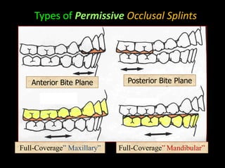 TMDs and occlusal splints therapy | PDF