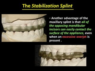 TMDs and occlusal splints therapy | PDF