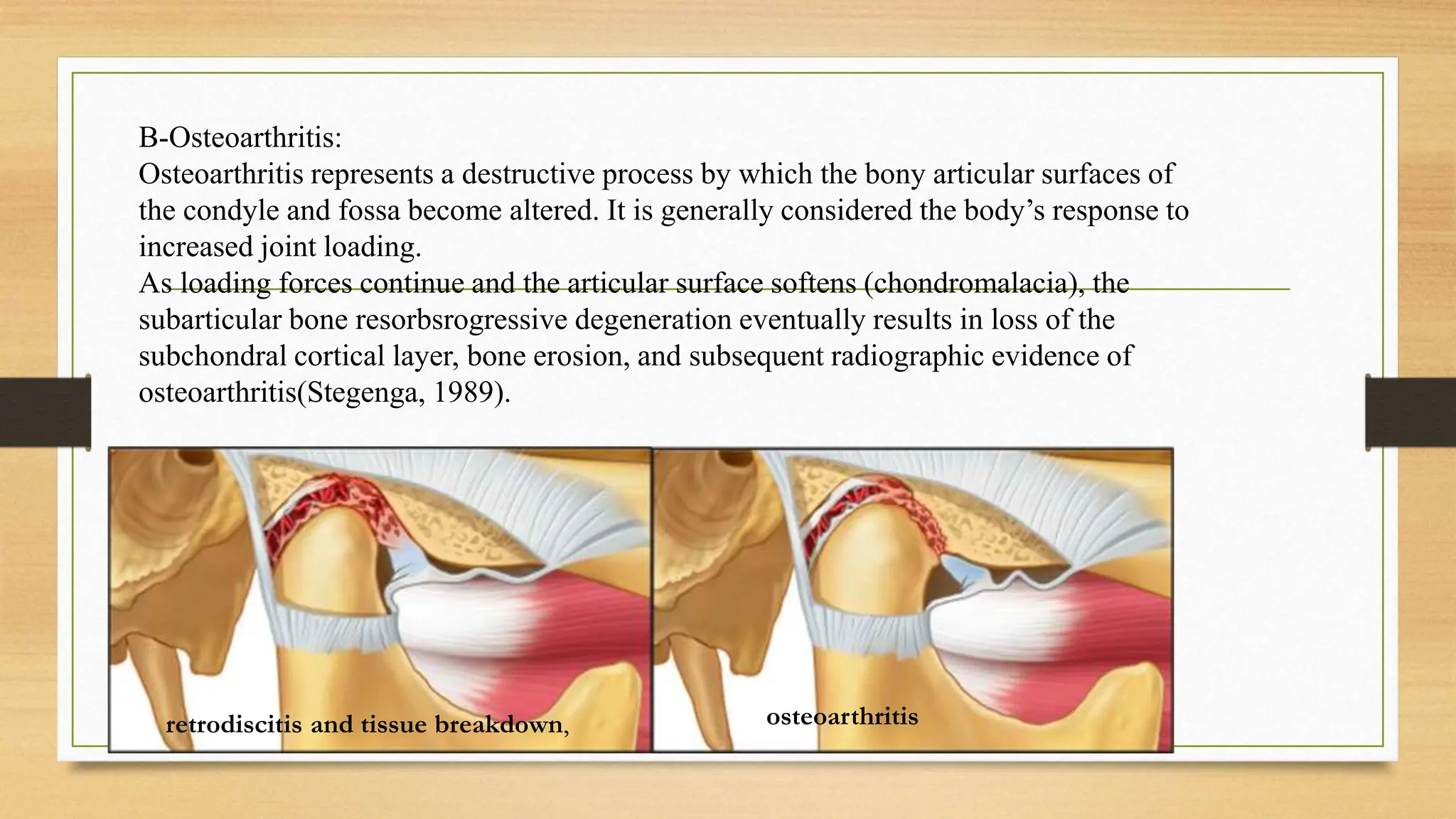 tempromandibuler disorder and ortho treatment ppt.pptx