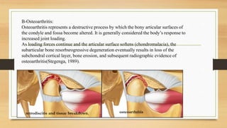 tempromandibuler disorder and ortho treatment ppt.pptx