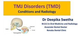 TMDs Assesment and management og TMJ disorders, TMJ mobilization | PPTX