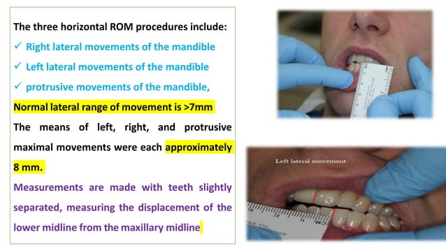 TMDs Assesment and management og TMJ disorders, TMJ mobilization | PPTX