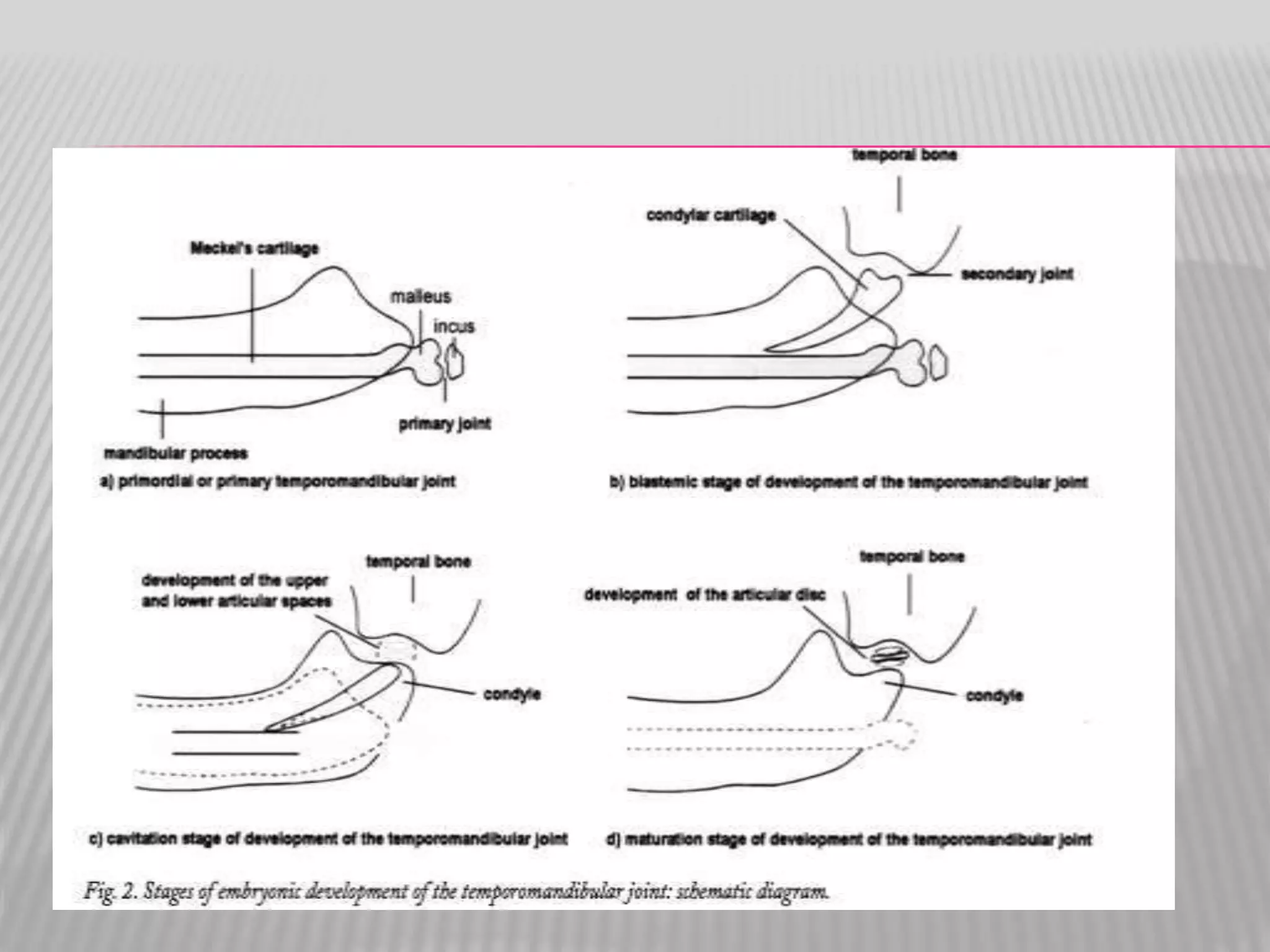 Temporomandibular Joint (TMJ ) | PPTX