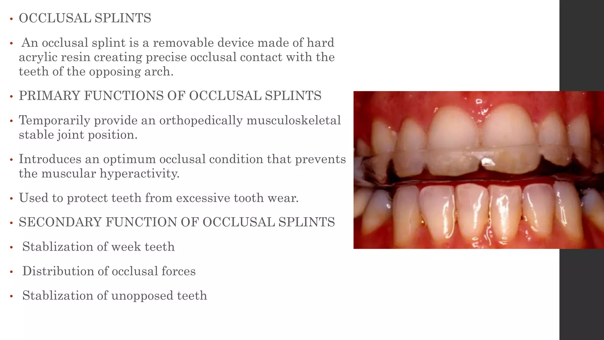 Temporomadibular joint and prosthodontic implications | PPTX