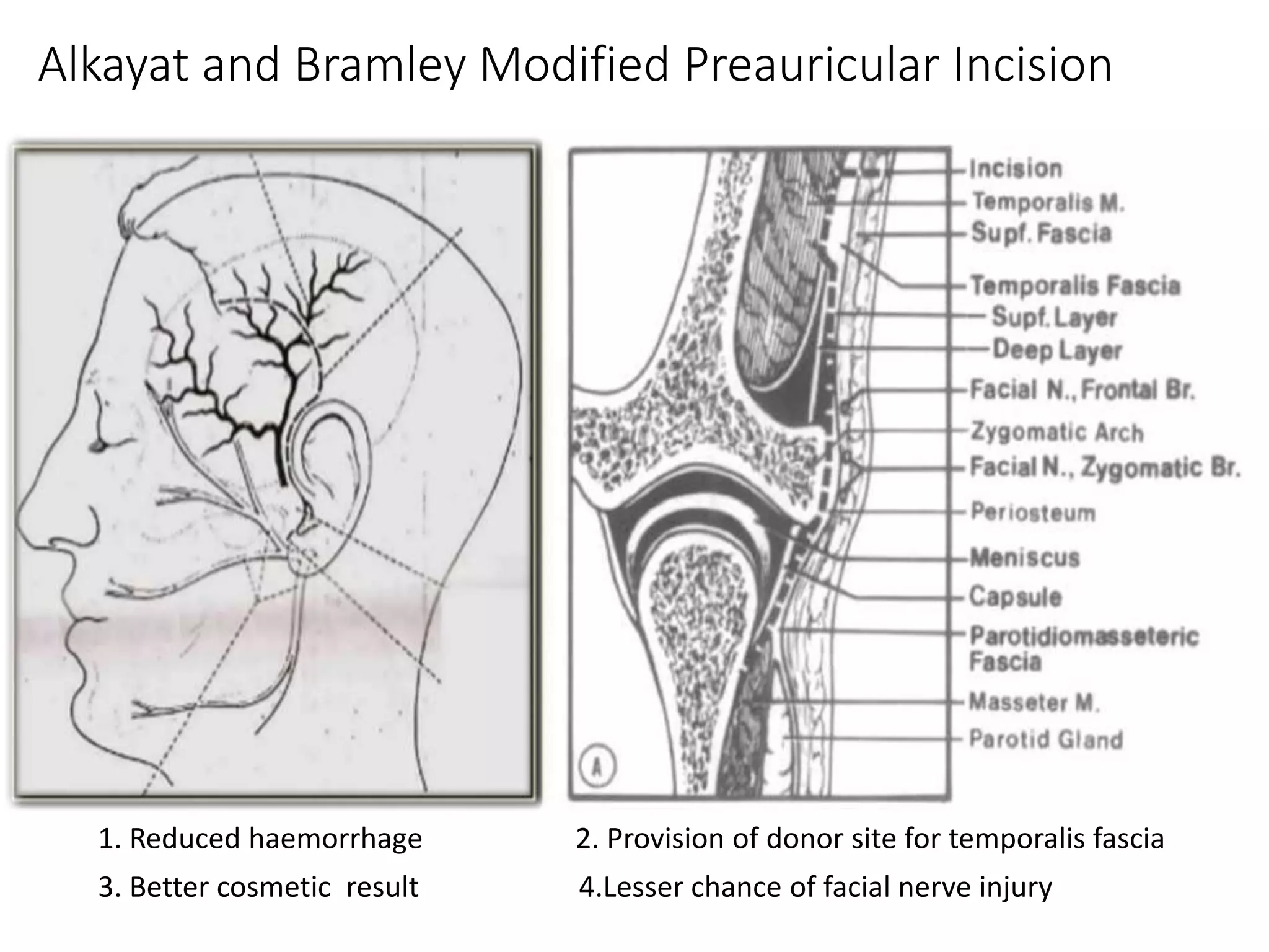 Surgical Anatomy of Temporomandibular Joint | PPTX
