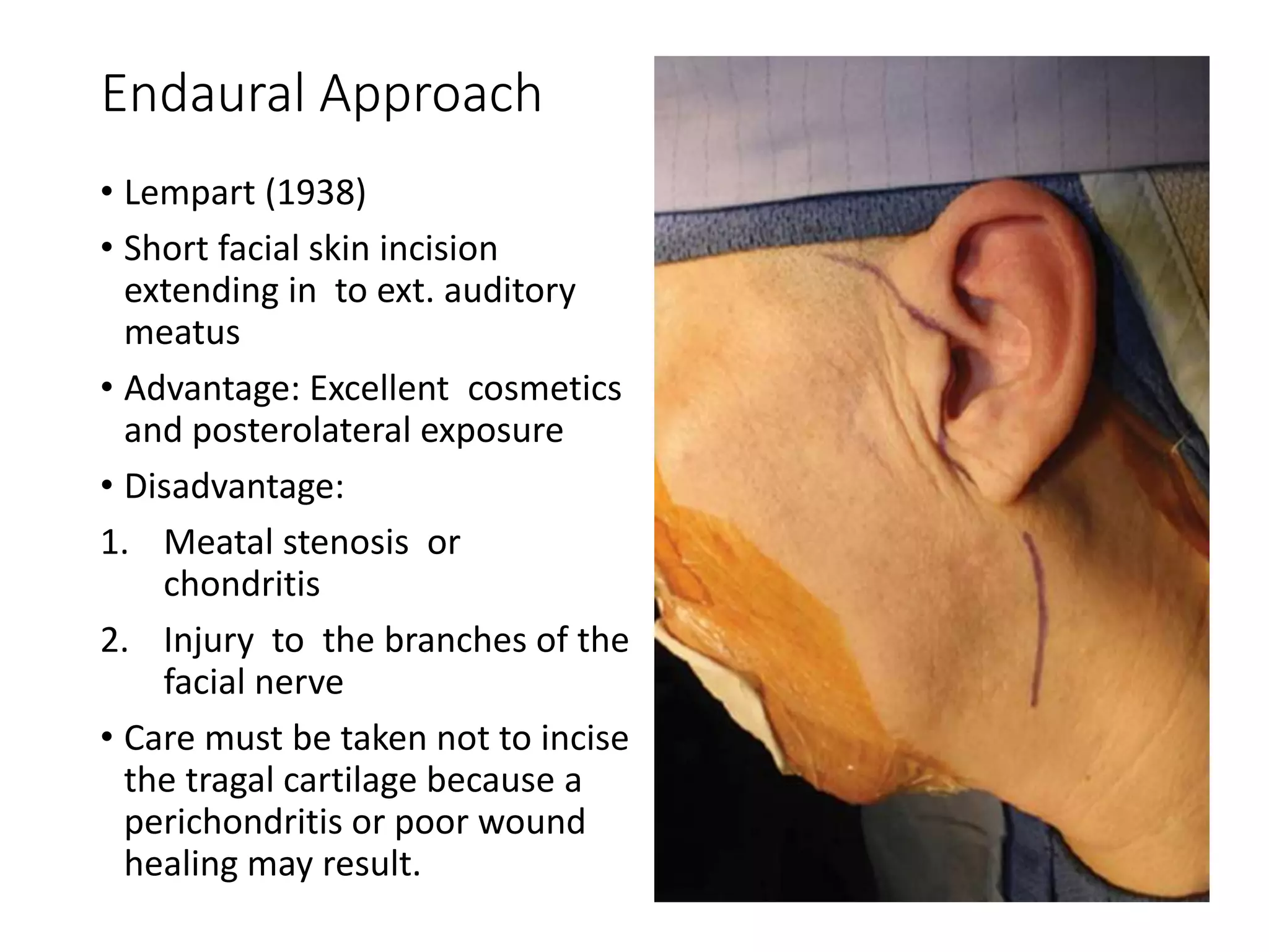 Surgical Anatomy of Temporomandibular Joint | PPTX
