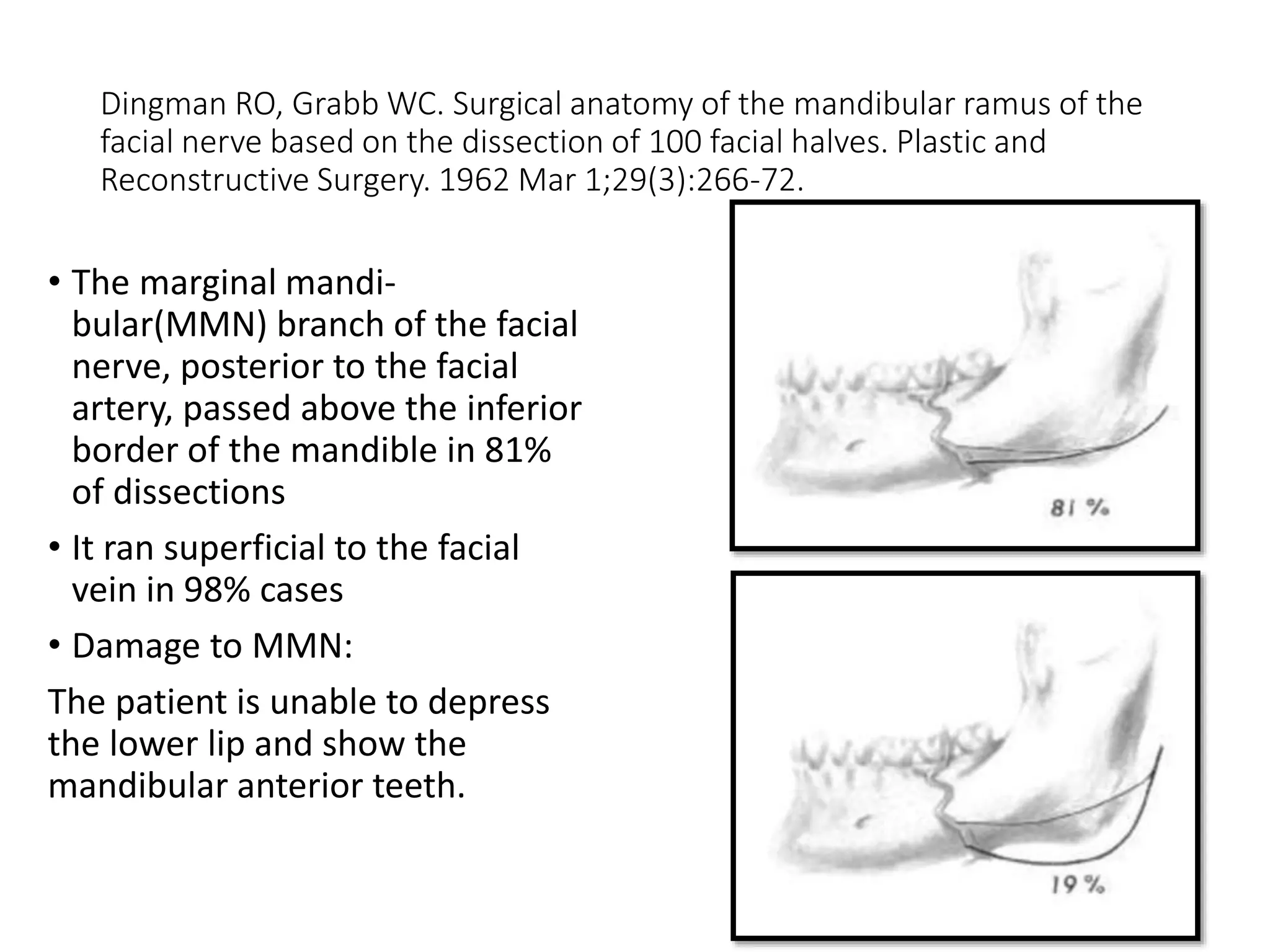 Surgical Anatomy of Temporomandibular Joint | PPTX