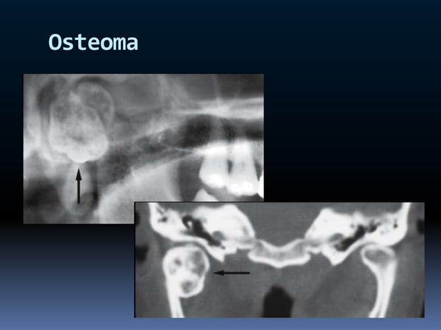 TMJ details and easy to understand it.ppt
