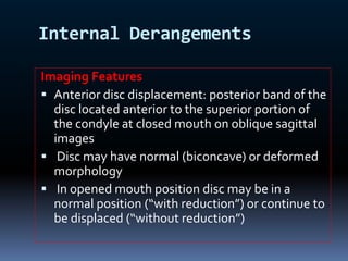 TMJ details and easy to understand it.ppt