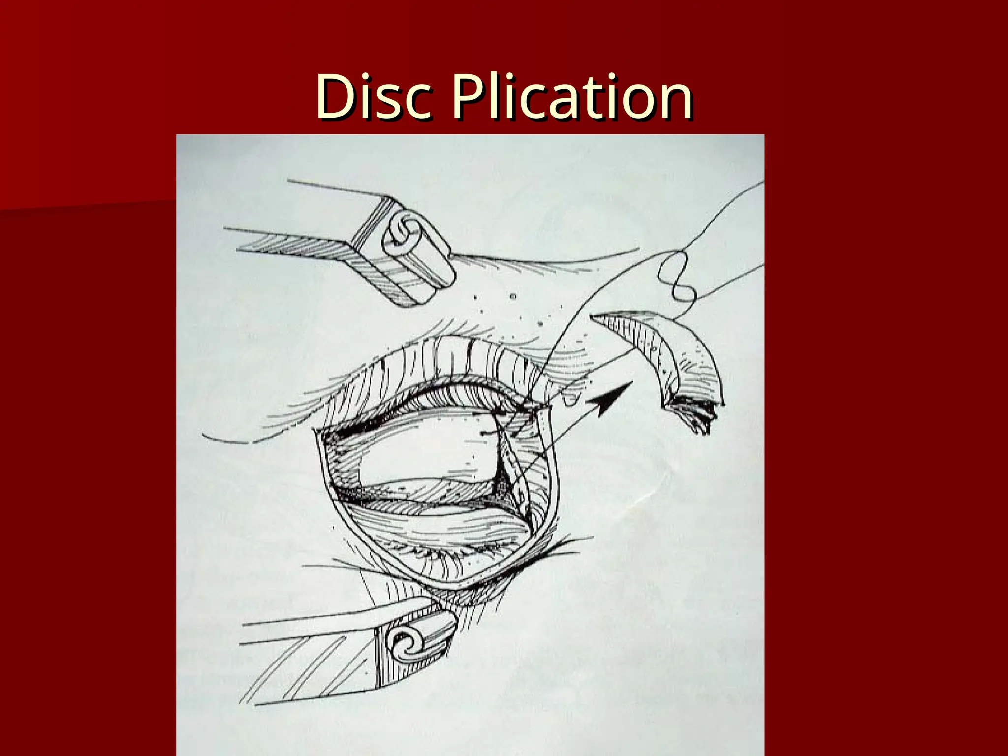 The Temporomandibular joint of the facial skeleton.ppt
