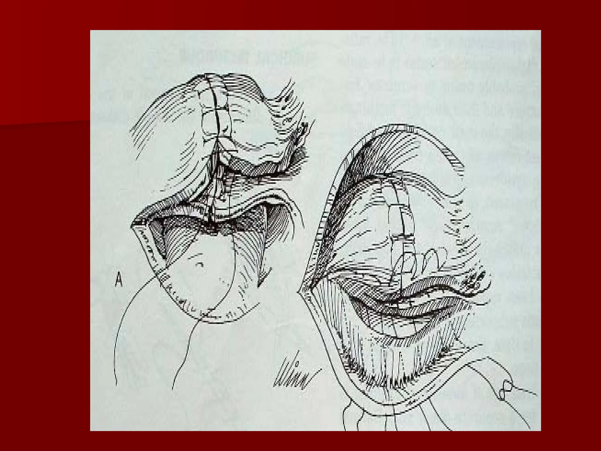 The Temporomandibular joint of the facial skeleton.ppt