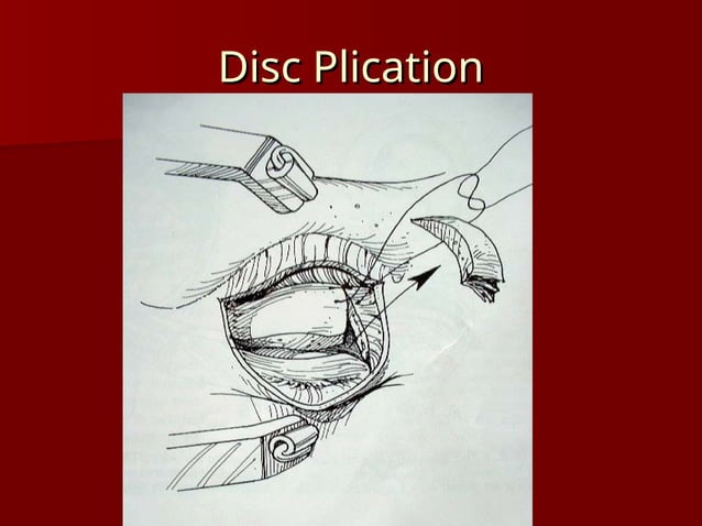 The Temporomandibular joint of the facial skeleton.ppt