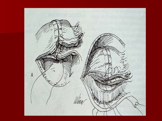 The Temporomandibular joint of the facial skeleton.ppt