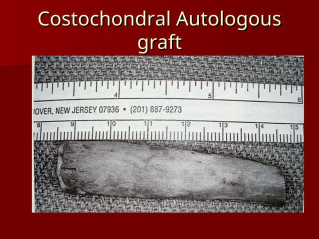 The Temporomandibular joint of the facial skeleton.ppt
