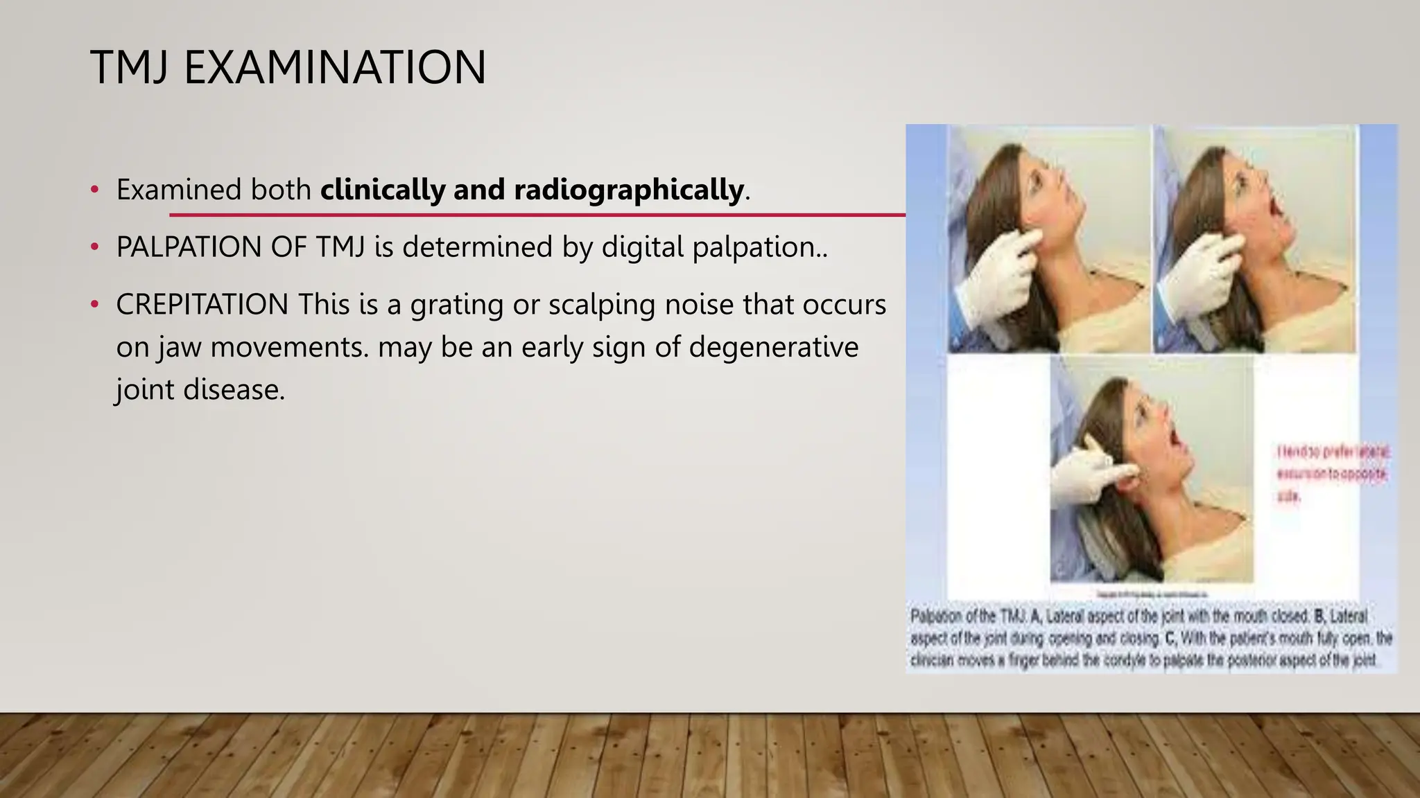TMJ - Copy.pptx ANATOMY EXAMINITION DISORDER | PPTX
