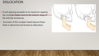 TMJ - Copy.pptx ANATOMY EXAMINITION DISORDER | PPTX