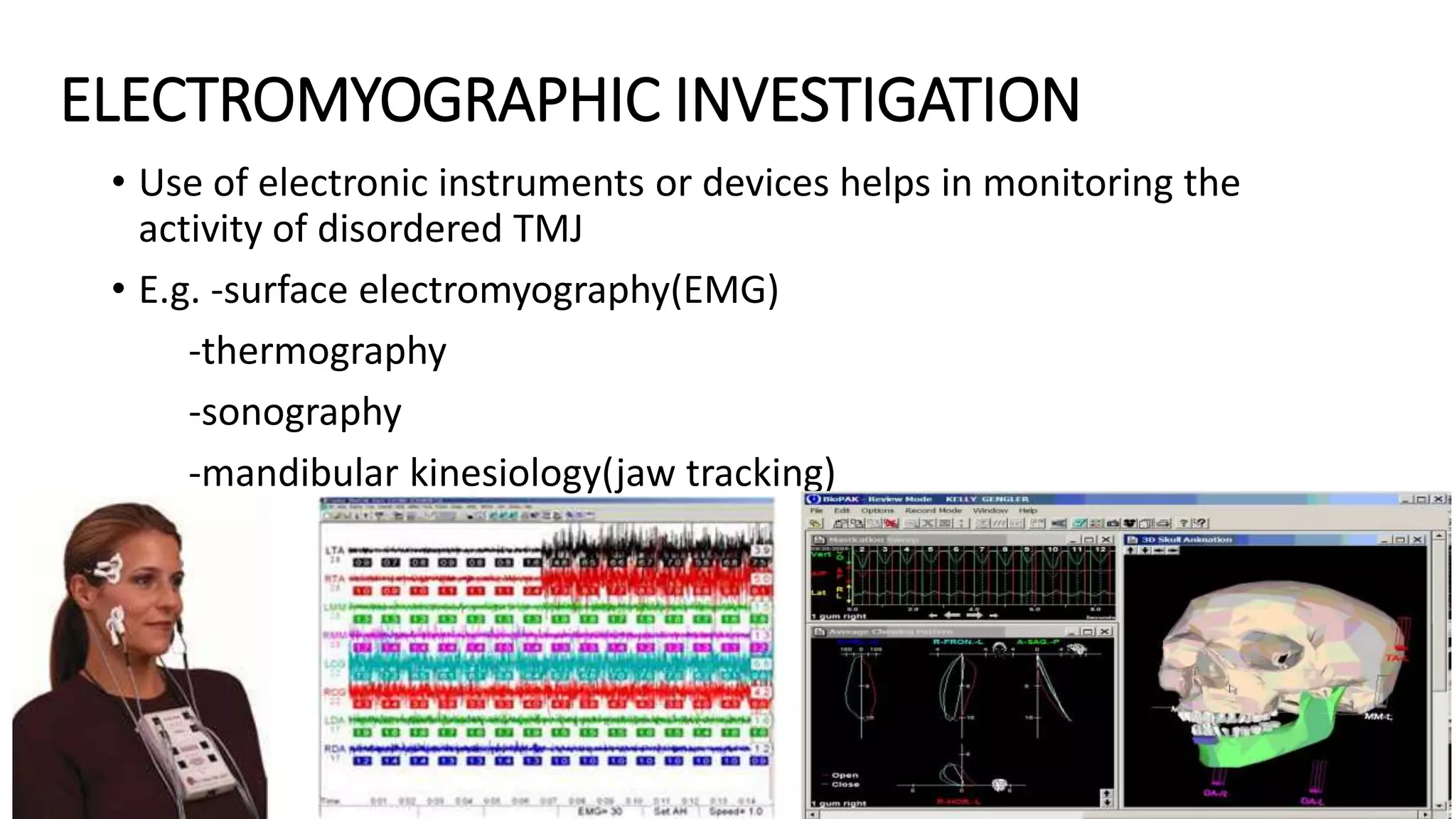 TMJ - ANATOMY & DISORDERS | PPTX