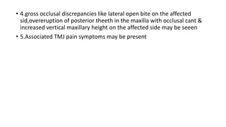 TMJ - ANATOMY & DISORDERS | PPTX